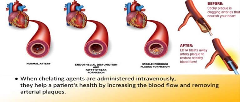 Edta in Chelation Therapy - Shanghai Chemex Group Ltd.
